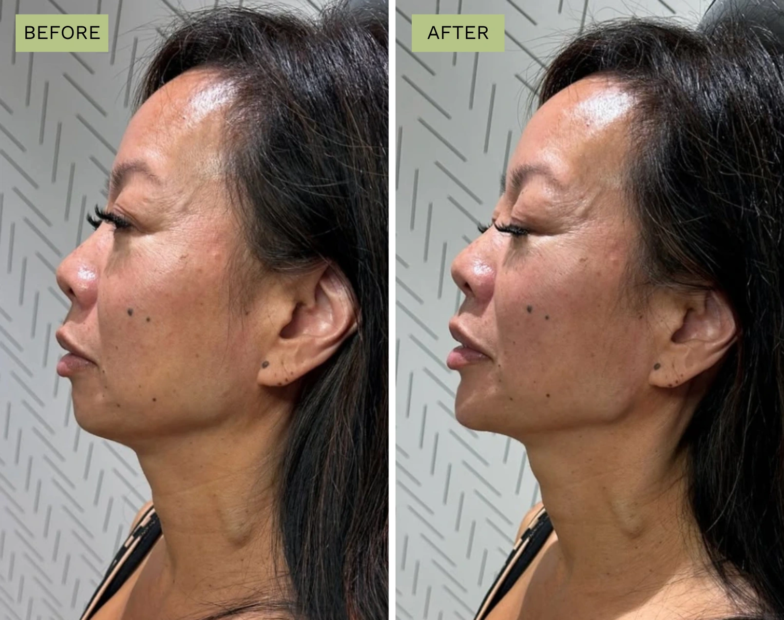 Jeff Goldstein in Sarasota, FL | Elite Medical Spa